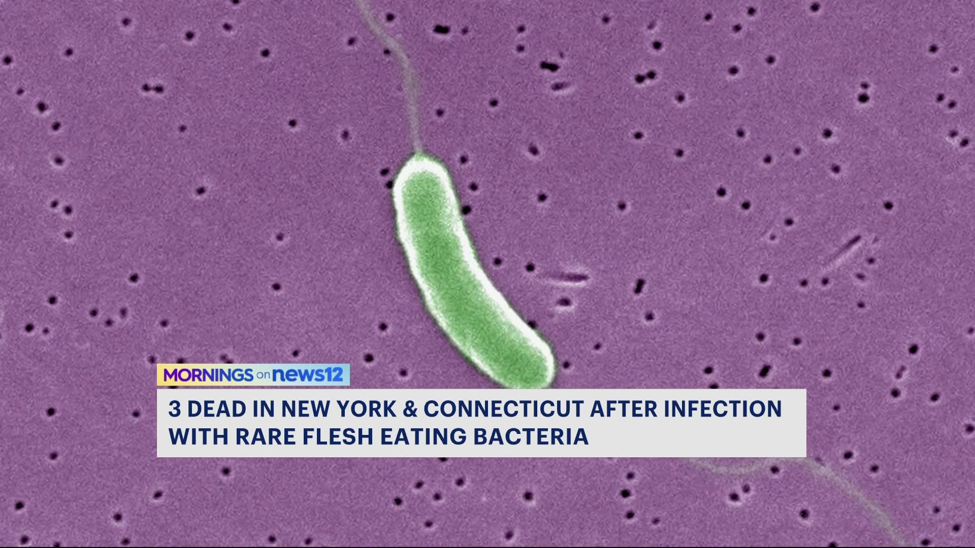 Bacteria found in raw shellfish linked to two Connecticut deaths also ...