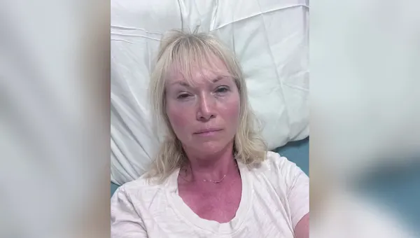 My Hip Was On Fire Former Tv News Anchor Says Wasp Stings Almost Killed Her