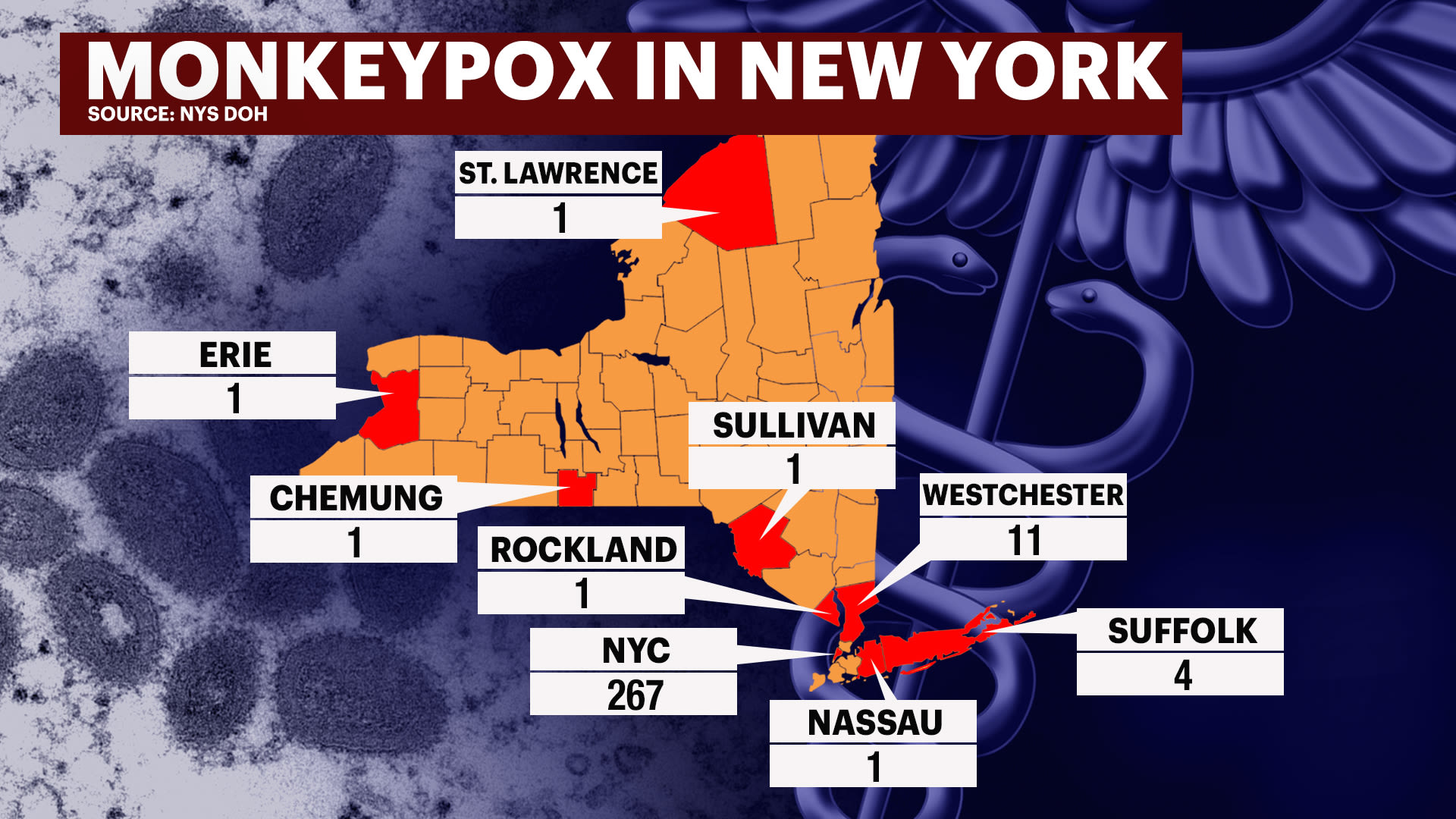 CDC: New York is 'epicenter' of US monkeypox outbreak, more vaccines coming