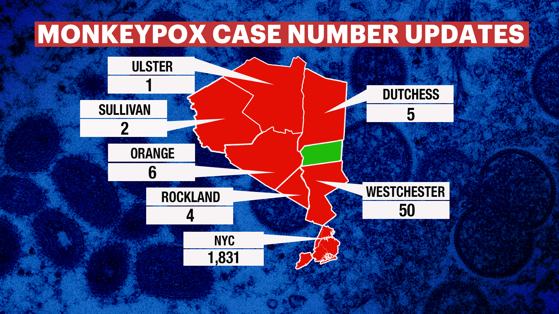 State updates monkeypox numbers across the Hudson Valley