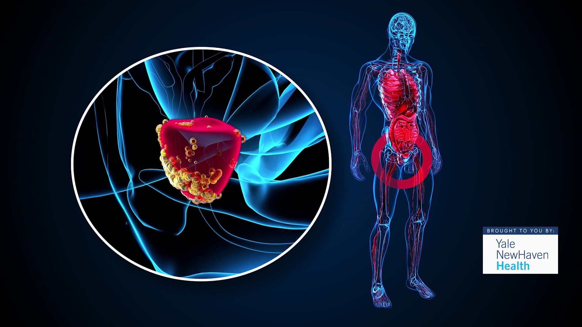 be Well: Procedure to treat enlarged prostate