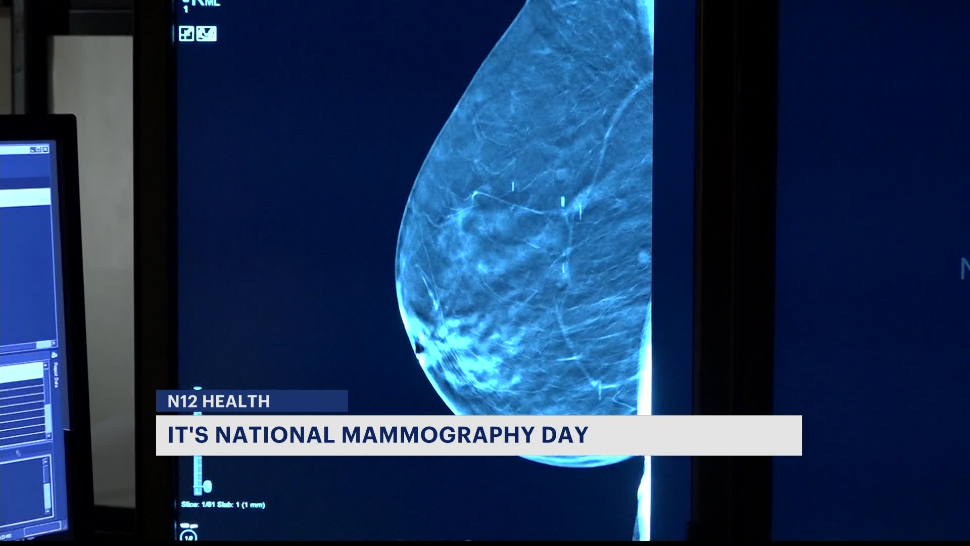 American Cancer Society reminds residents to get screened for breast ...