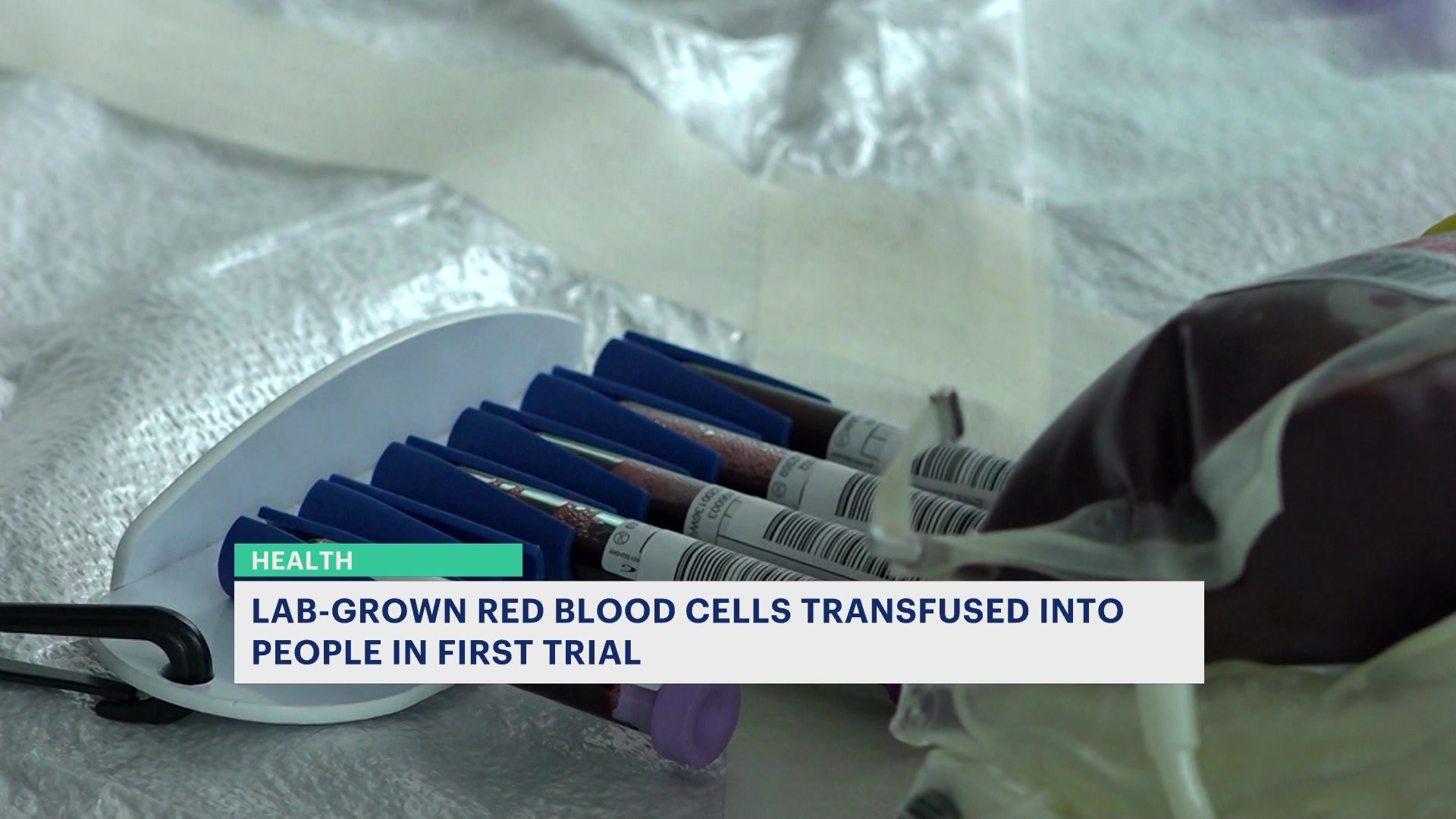 UK volunteers receive first ever lab-grown red blood cells during ...