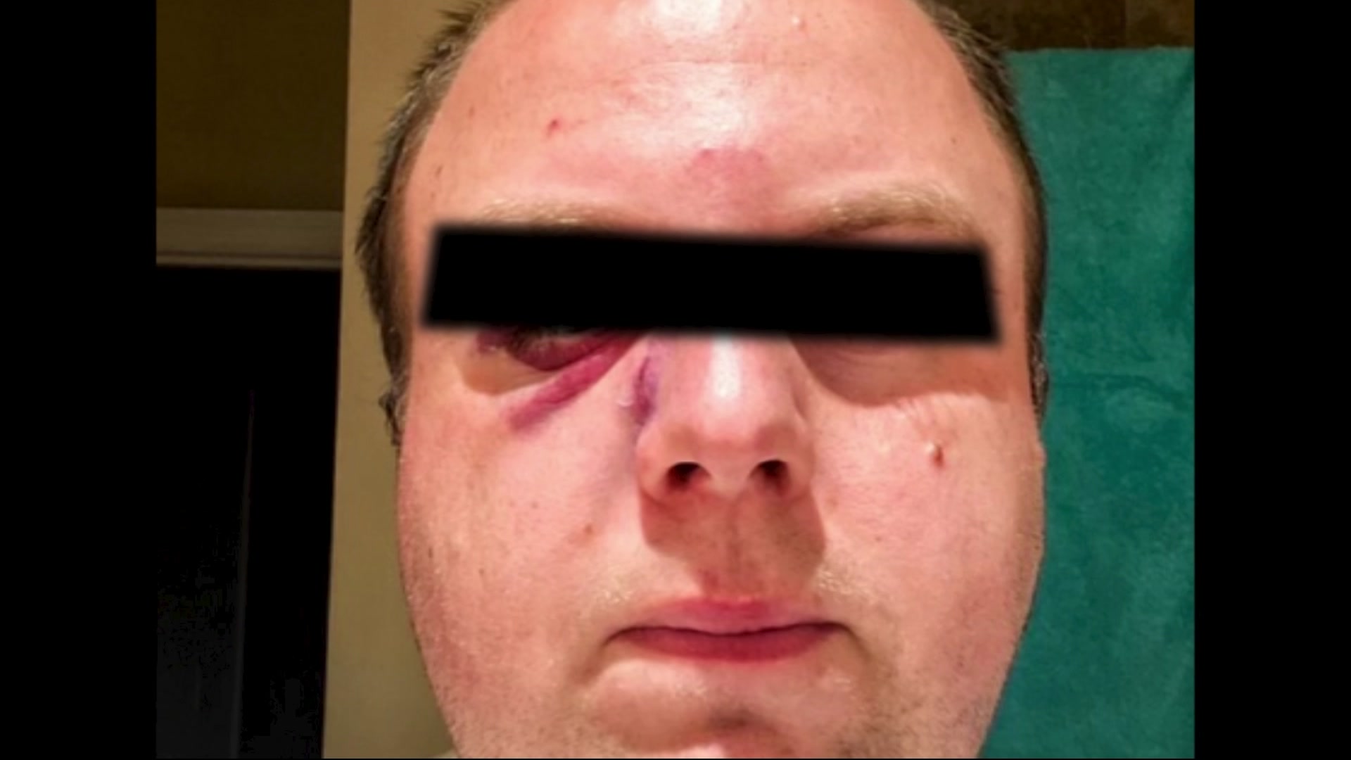 News 12 | Hudson Valley | Photos Show Injured Corrections Officers As ...