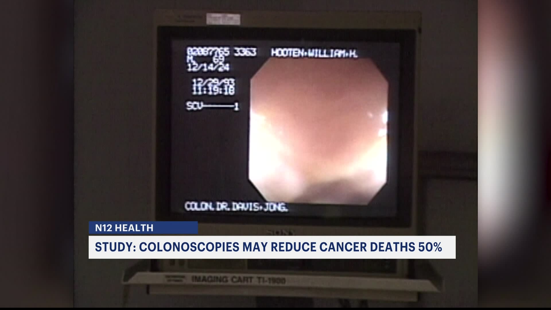 Study: Colonoscopies only reduce the risk of dying of colorectal cancer ... Study: Colonoscopies only reduce the risk of dying of colorectal cancer ...