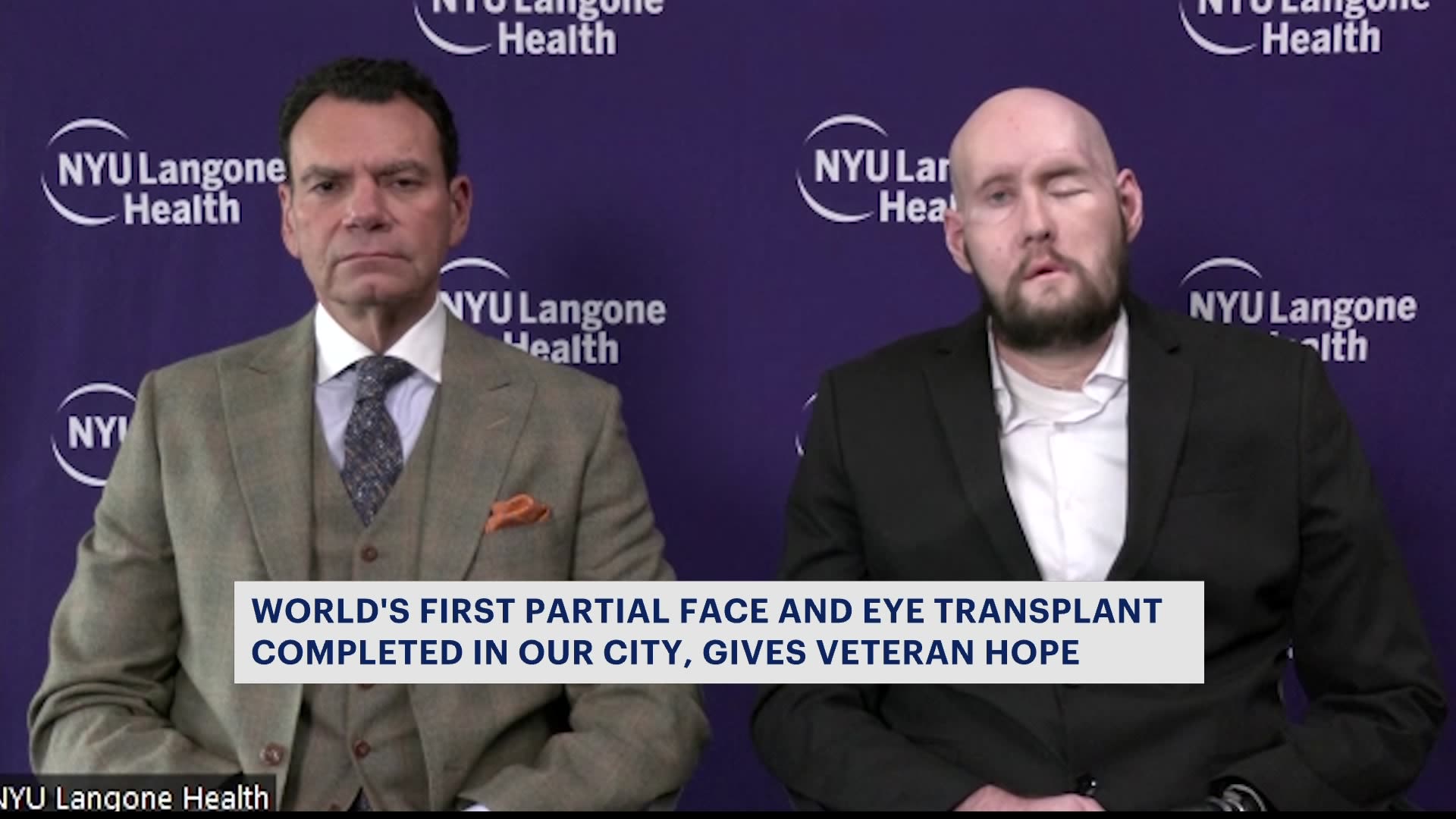 First full-eye and face transplant performed in NYC