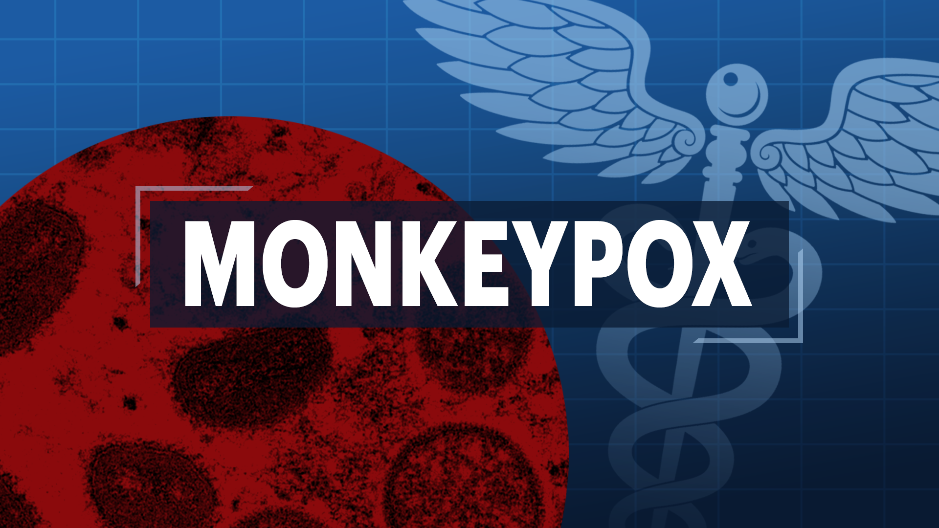 New Jersey reports first death tied to monkeypox