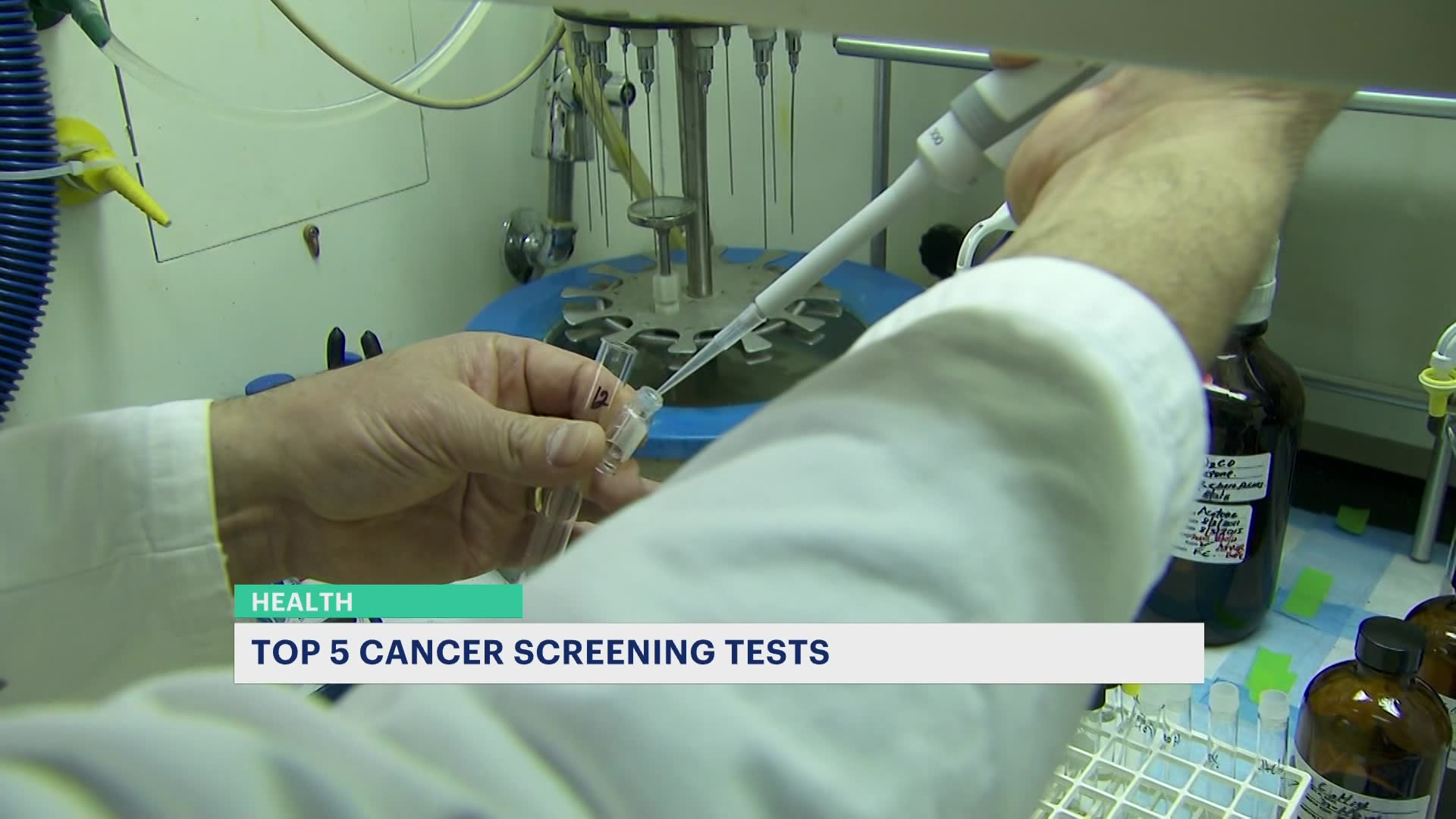 5 cancer screening tests to know about and when to get them