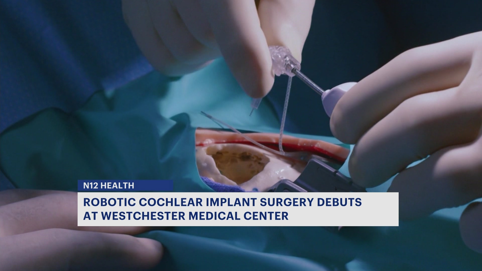 News 12 | New York | Westchester Medical Center pioneers robotic ...