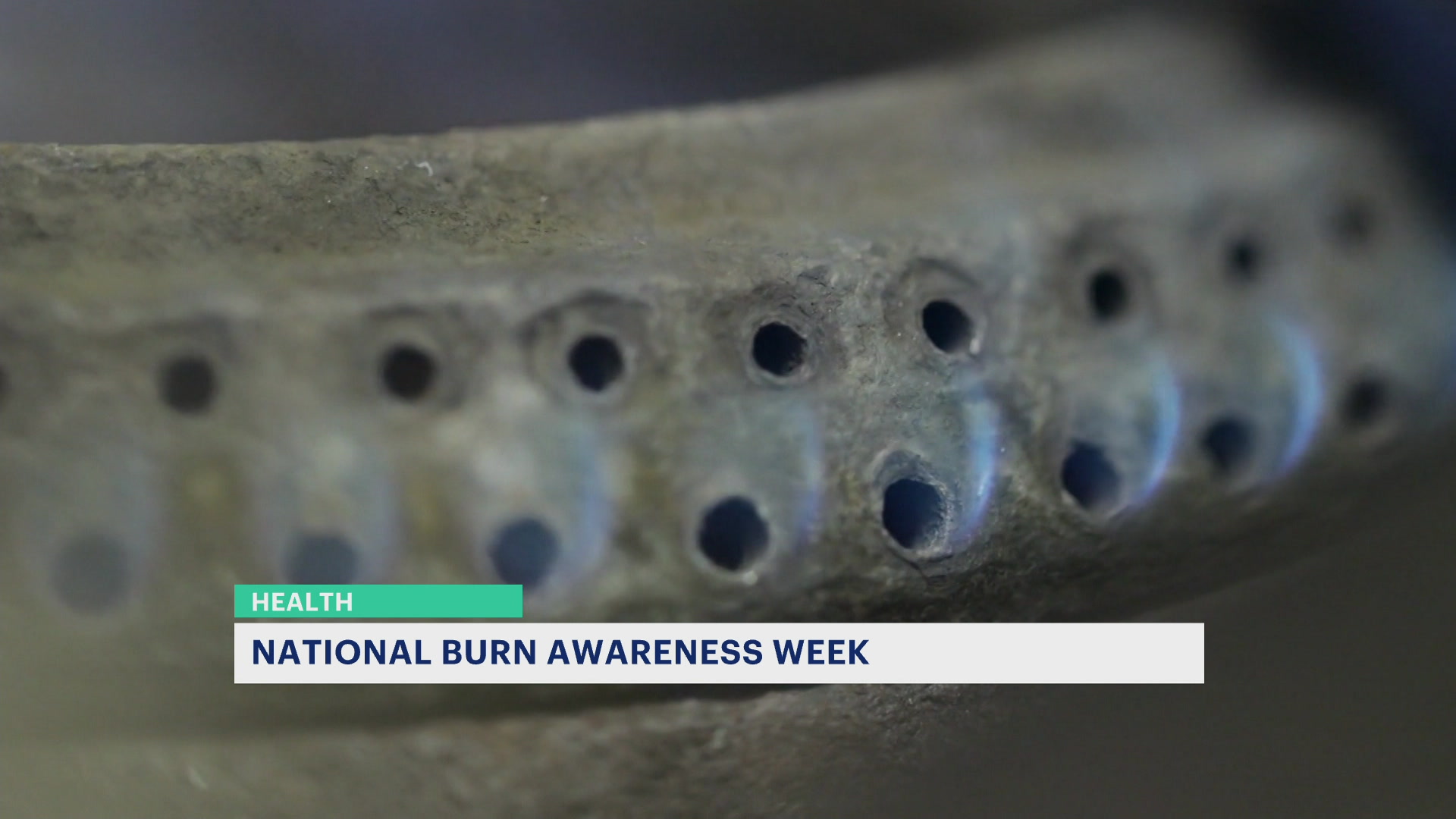 'Prevention is best.' Health experts provide safety tips on burn ...