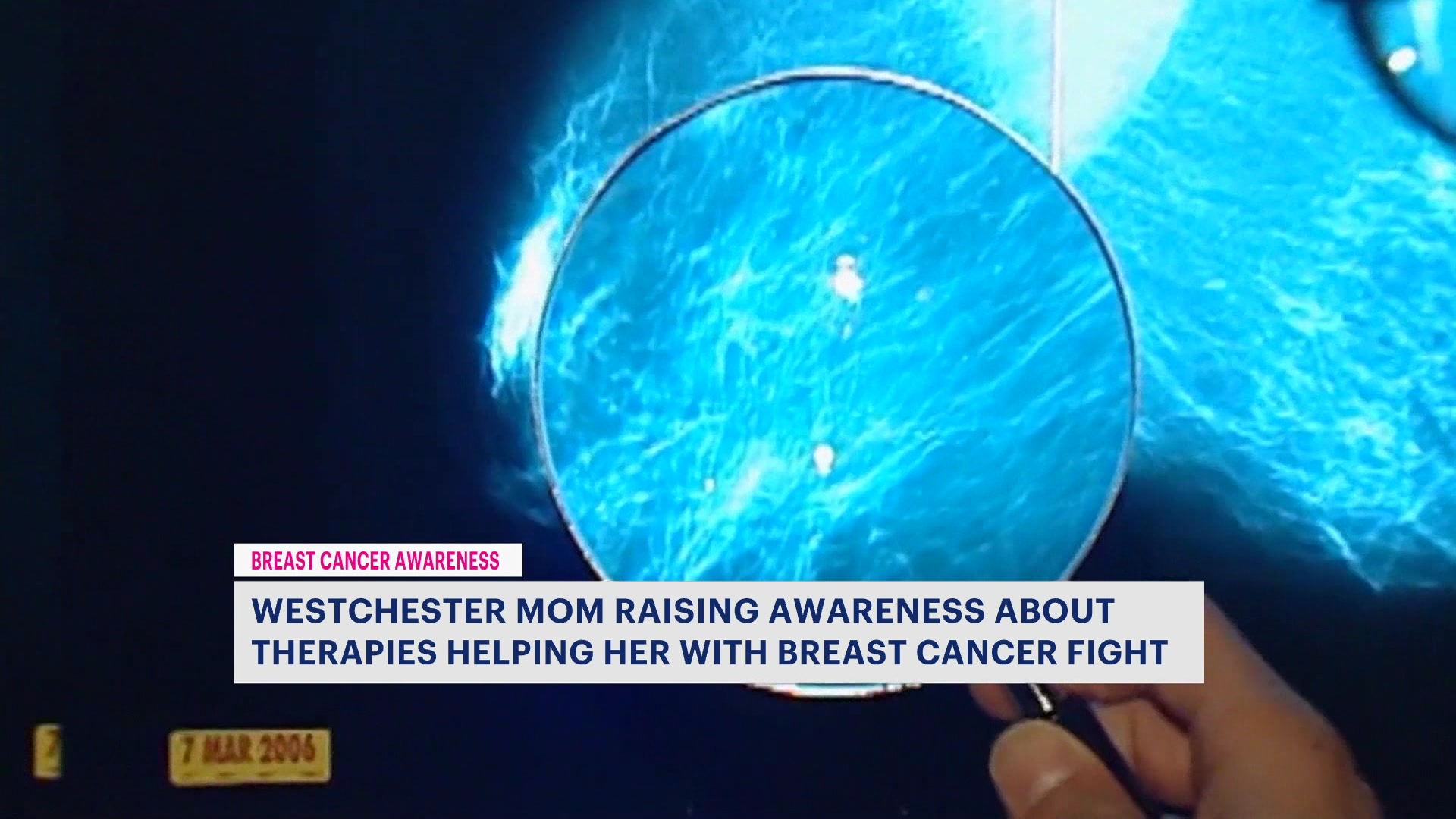 News 12 | New York | Breast cancer 'thriver' raises awareness about ...
