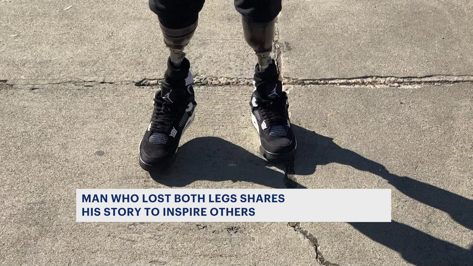 Survivor of double leg amputation shares his story to inspire others ...