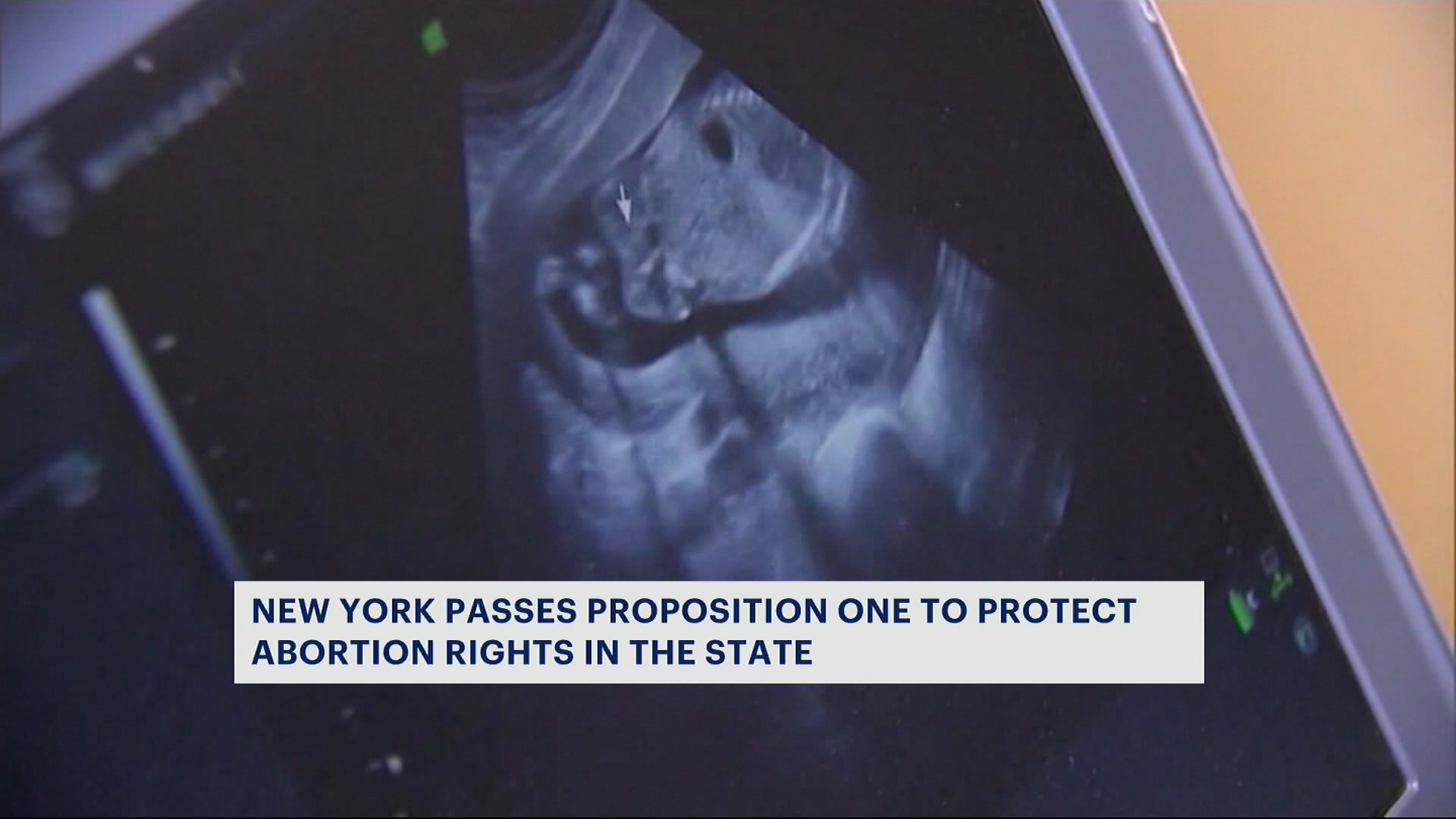 News 12 | Brooklyn | Passing Of Proposition 1 Alleviates Fears For ...