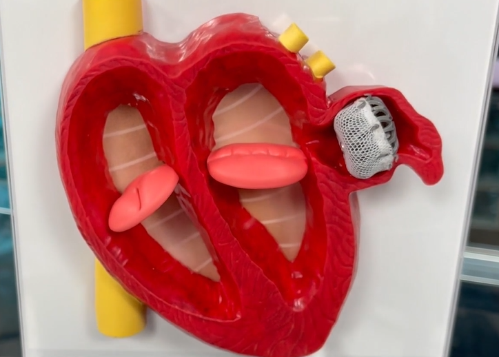 What is the latest in Atrial fibrillation and Afib Apps